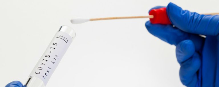 Examen PCR Covid-19 - Clínica Andes Salud El Loa